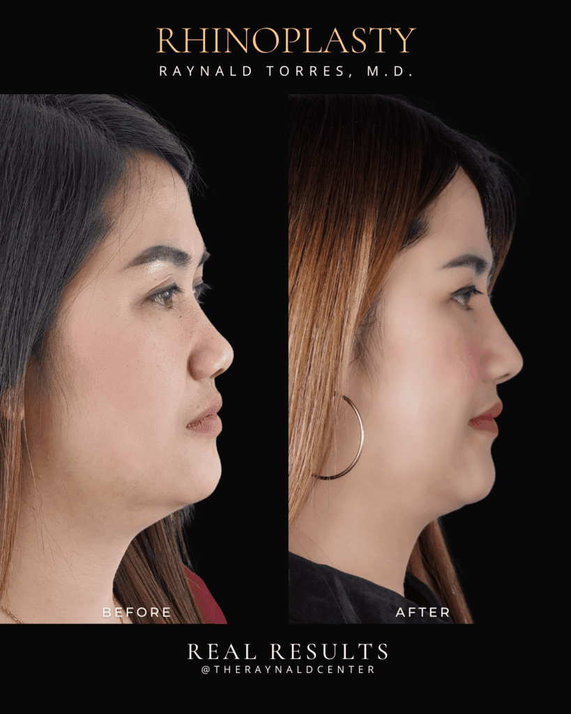 Gallery – Raynald Center